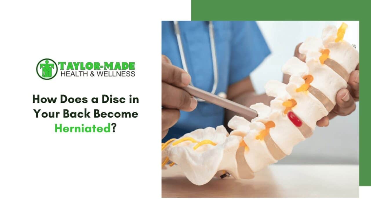 How Does a Disc in Your Back Become Herniated | Taylored Wellness